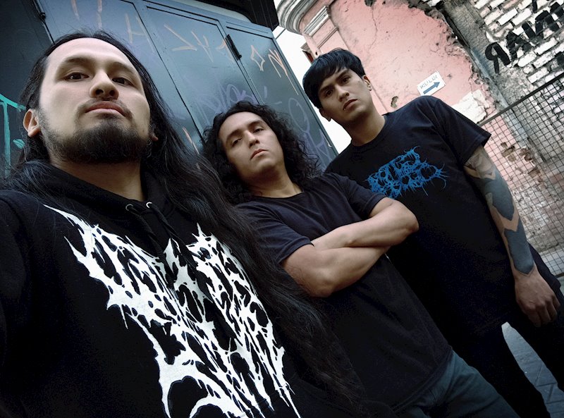INTESTINAL LACERATION – radio highway pirates..